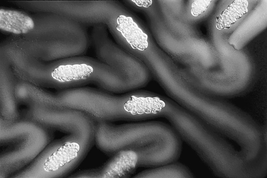 Freshwater Ascomycetes - Species Monograph