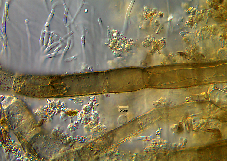 Freshwater Ascomycetes - Species Monograph