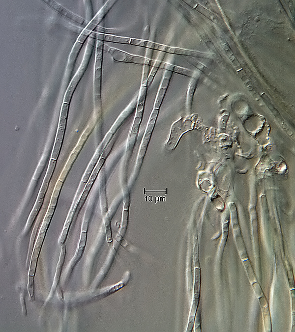 Freshwater Ascomycetes - Species Monograph