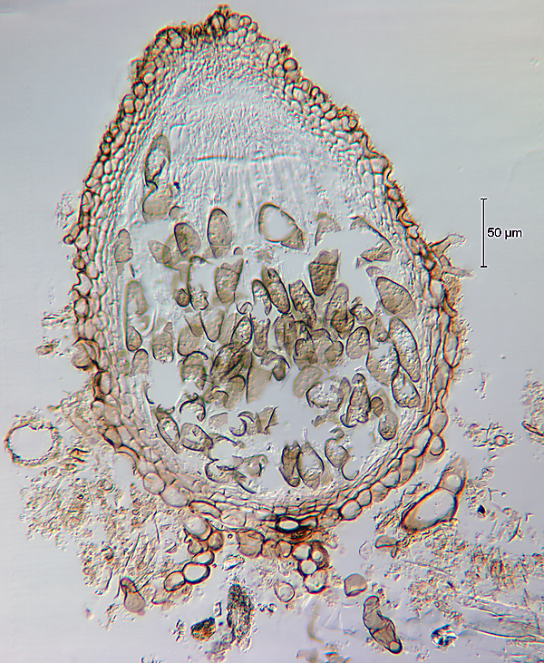 Freshwater Ascomycetes - Species Monograph
