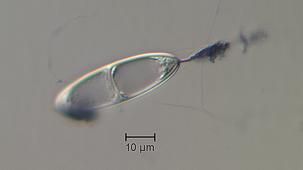 Freshwater Ascomycetes - Species Monograph