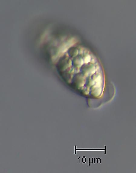 Freshwater Ascomycetes - Species Monograph