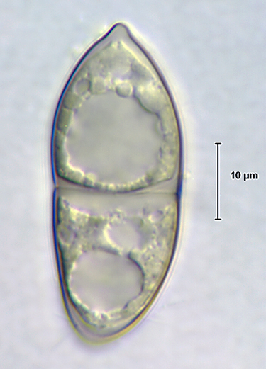 Freshwater Ascomycetes - Species Monograph