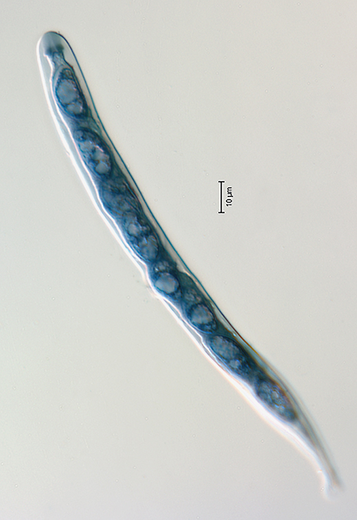 Freshwater Ascomycetes - Species Monograph