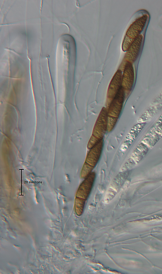 Freshwater Ascomycetes - Species Monograph