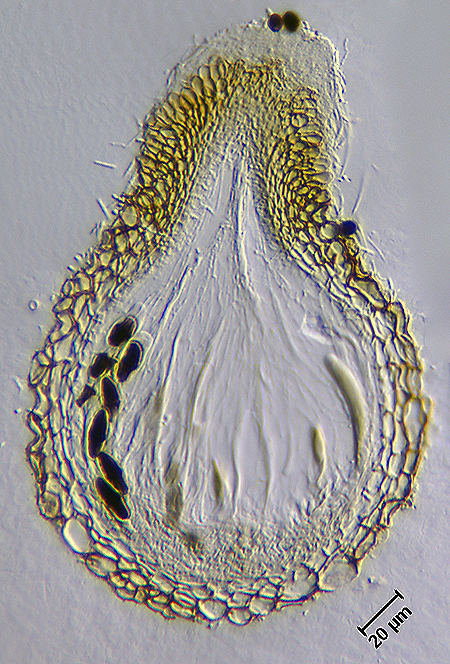 Freshwater Ascomycetes - Species Monograph