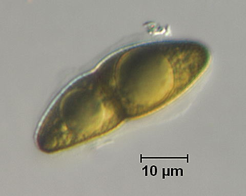 Freshwater Ascomycetes - Species Monograph