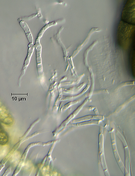 Freshwater Ascomycetes - Species Monograph