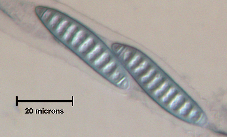 Freshwater Ascomycetes - Species Monograph