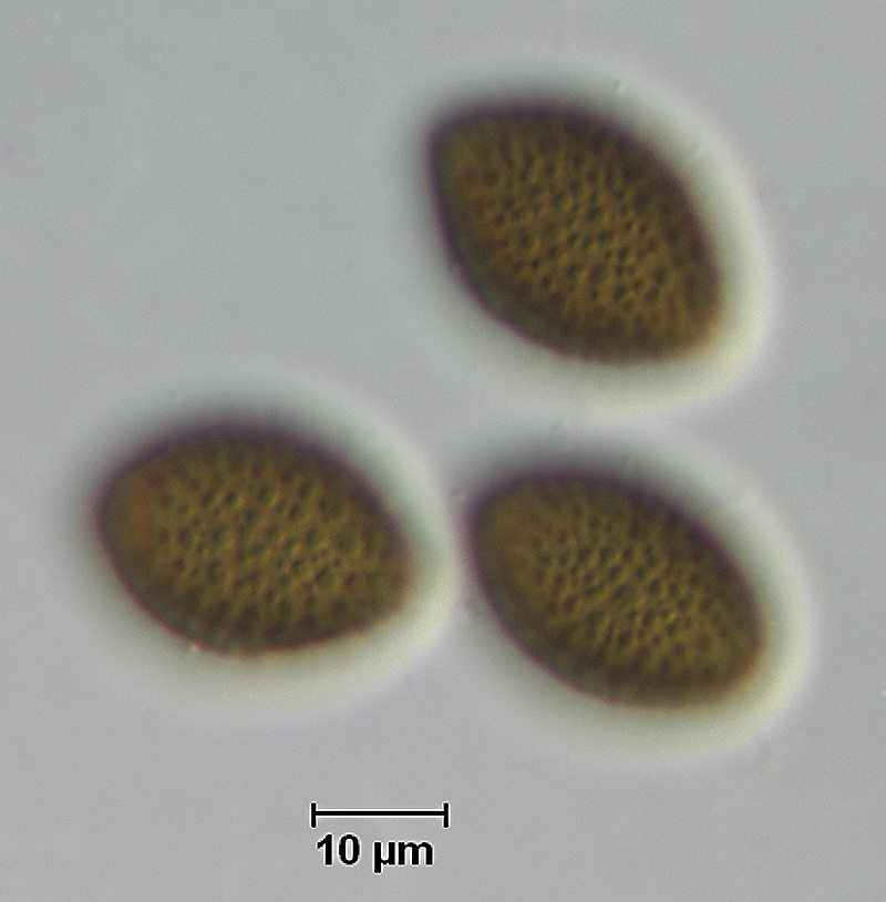 Freshwater Ascomycetes - Species Monograph