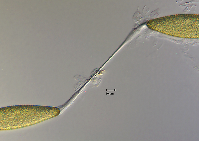 Freshwater Ascomycetes - Species Monograph