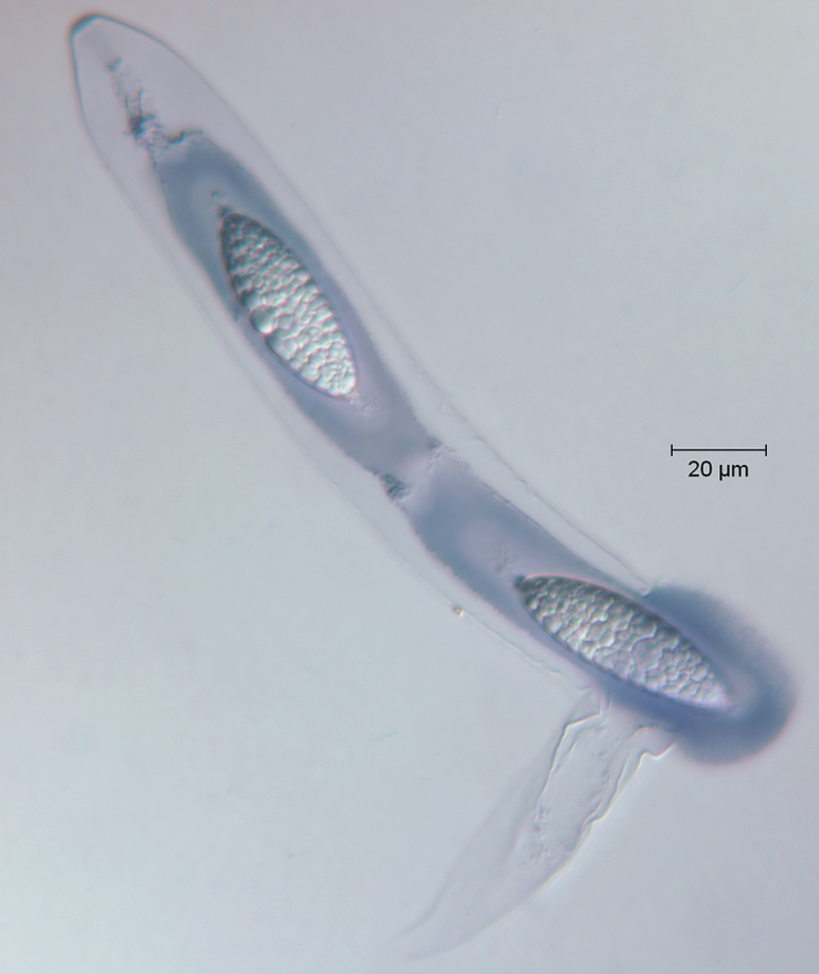 Freshwater Ascomycetes - Species Monograph