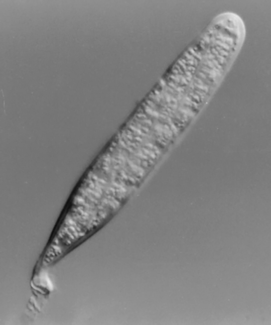 Freshwater Ascomycetes - Species Monograph