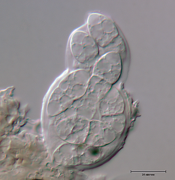 Freshwater Ascomycetes - Species Monograph